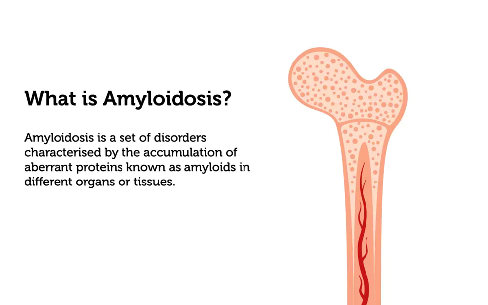 Lysozyme used as Amyloidosis model for study UPSC