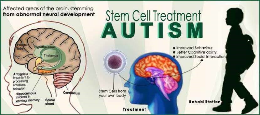 Care Stem cell therapy and autism UPSC