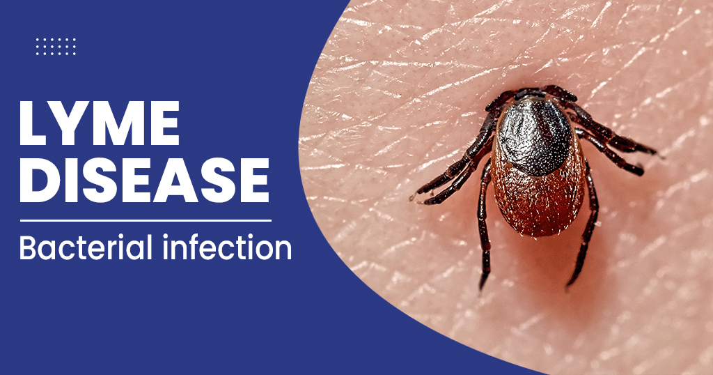 Us Did Not Find Misconduct At Trial Of Lyme Disease Vaccine Upsc