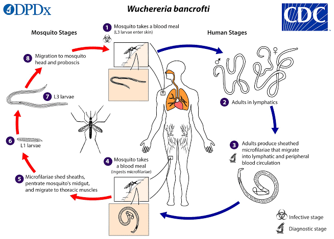 Lymphatic Filariasis UPSC