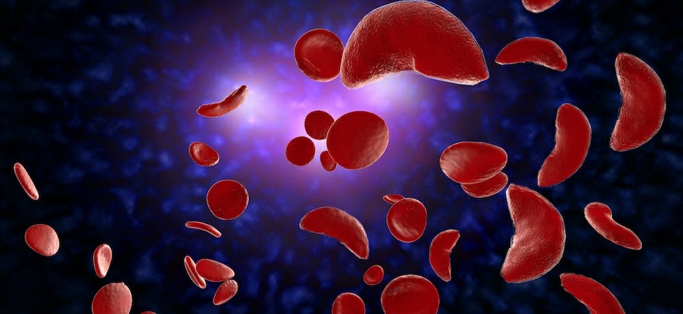 NATIONAL SICKLE CELL ANAEMIA ELIMINATION MISSION