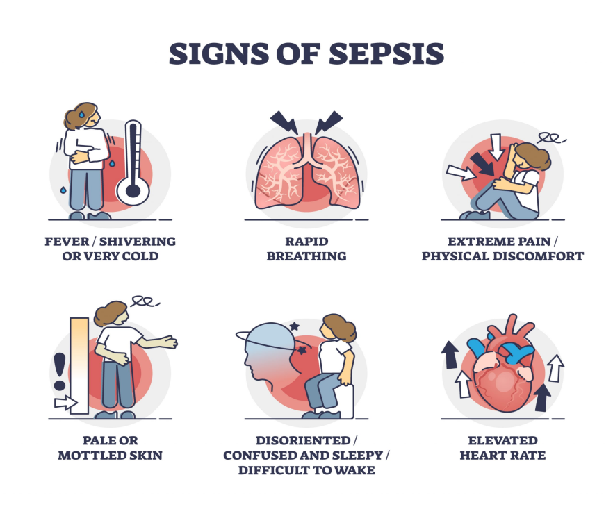 Deprivation, health issues amplify sepsis risk UPSC