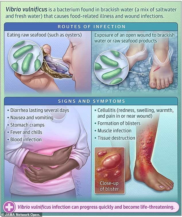 Vibrio vulnificus or flesh-eating bacteria spreading in the US UPSC