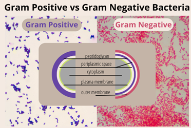 GRAM-NEGATIVE BACTERIA | IAS GYAN