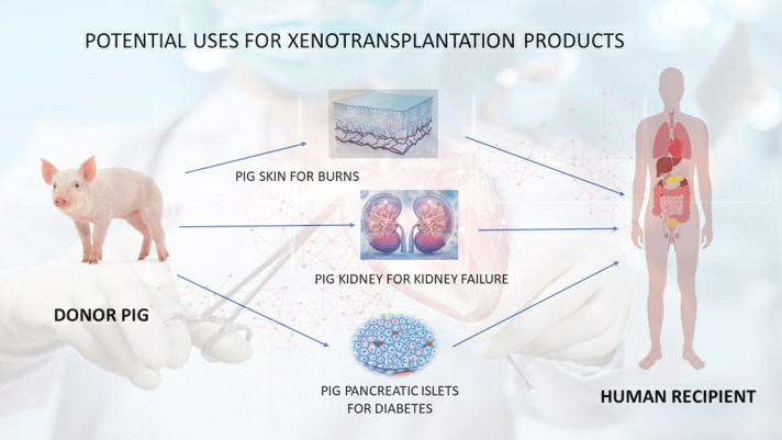 XENOTRANSPLANTATION - IAS Gyan